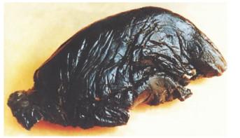 梦神之花，堕落之果——吗啡